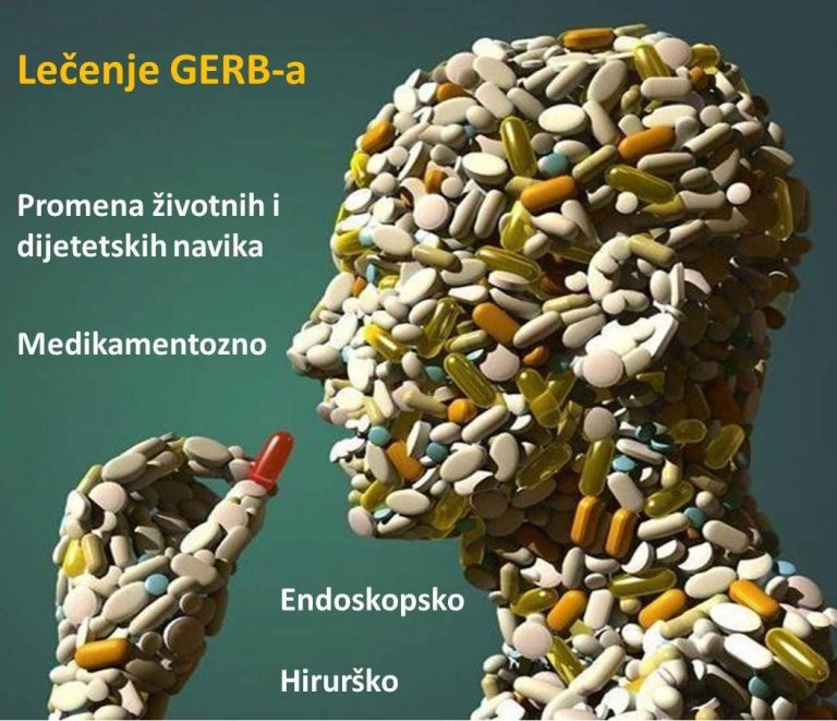 Kozervativno lečenje GERB-a i želudačnih kila